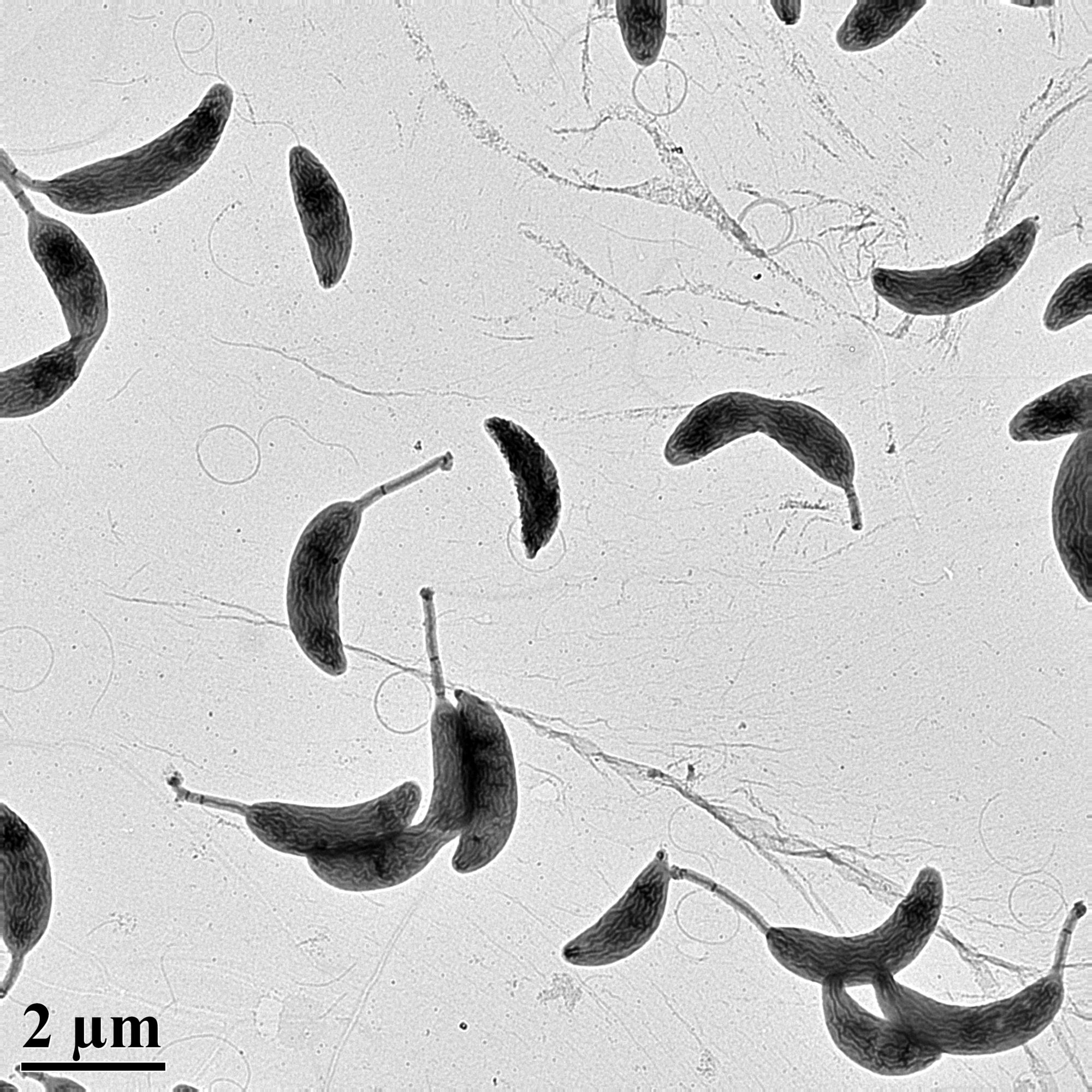 Transmission electron micrograph of Caulobacter (Berne) – Brun Lab